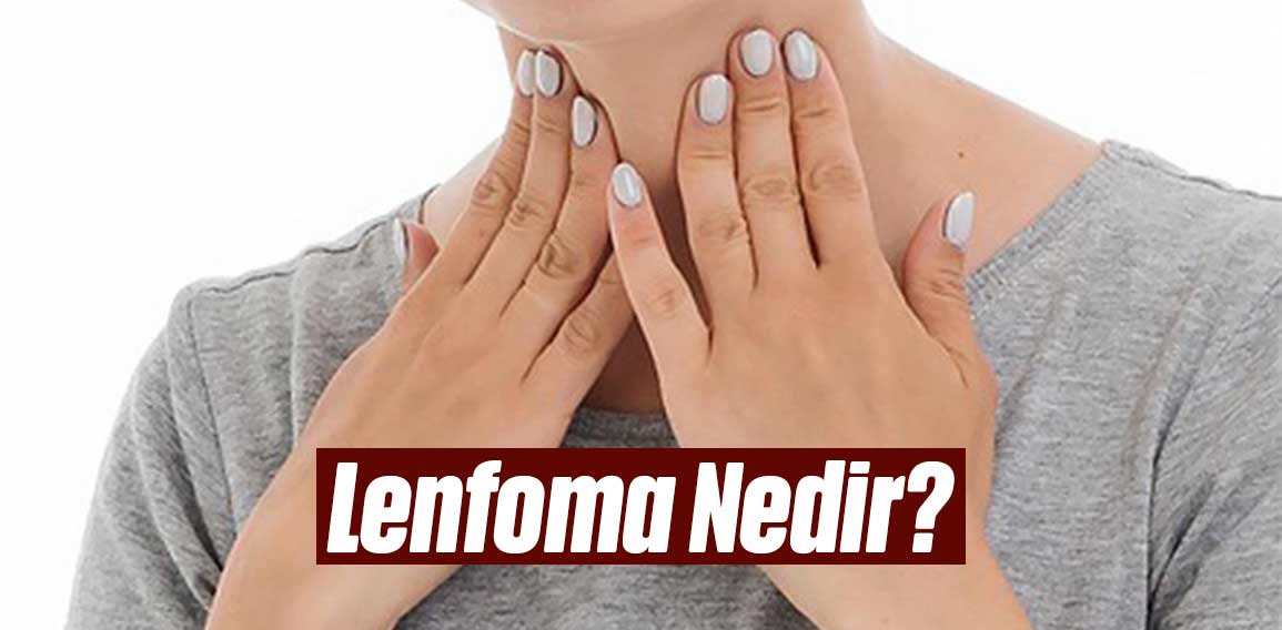 Lenfoma Nedir? - Kütahya Ekspres